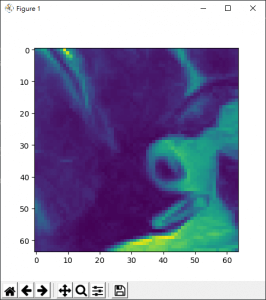 Python 使用 Pydicom 讀取、編輯 DICOM 影像檔案教學與範例 - Office 指南