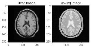 SimpleElastix 影像對準工具安裝、基本使用教學與範例 - Office 指南