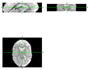 Python 讀取、顯示 NIfTI 影像教學與範例 - Office 指南