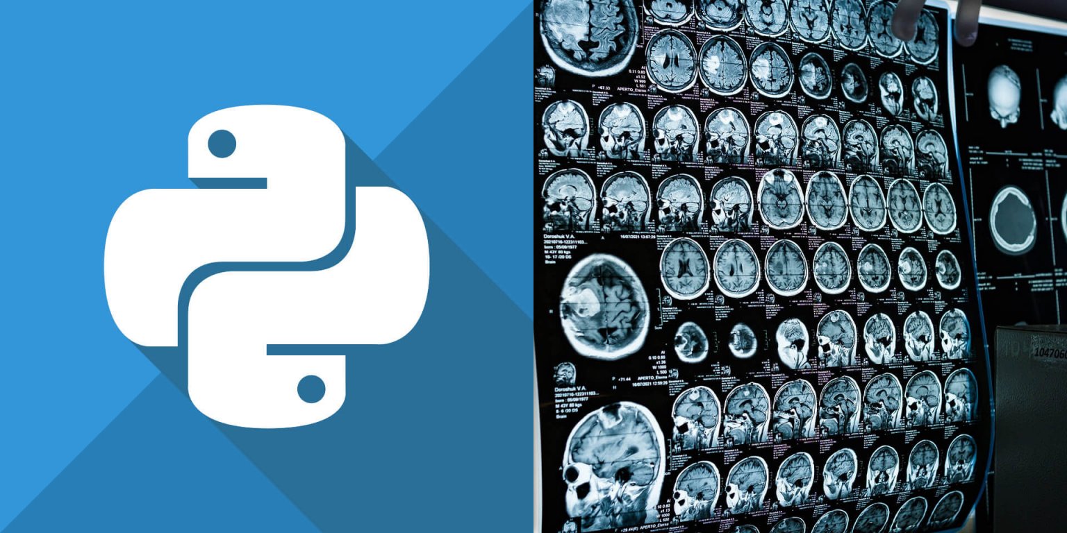 Python 讀取、顯示 NIfTI 影像教學與範例 - Office 指南